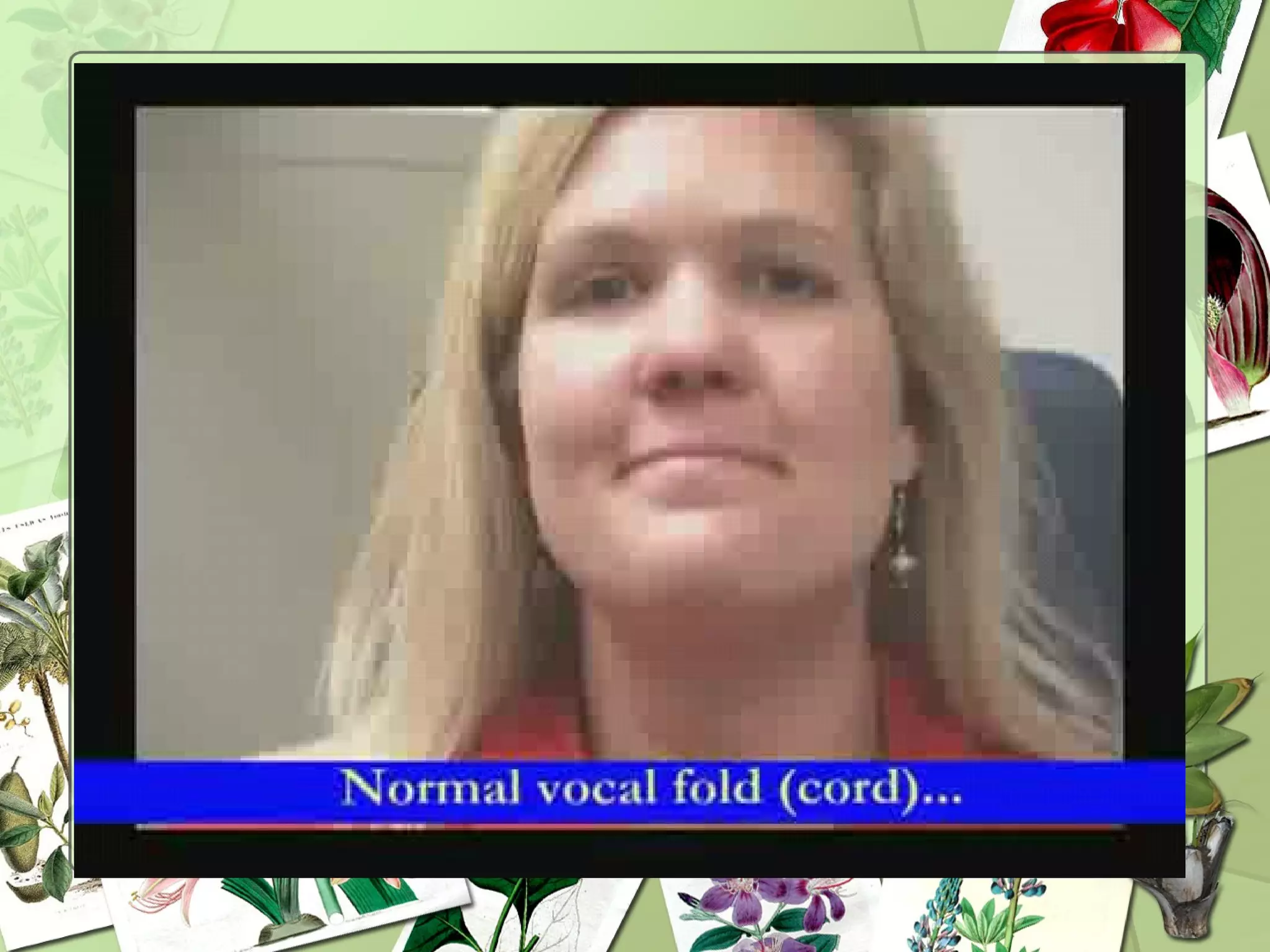 Laryngitis Ppt