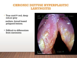 acute and chronic Laryngitis and lesions.ppt