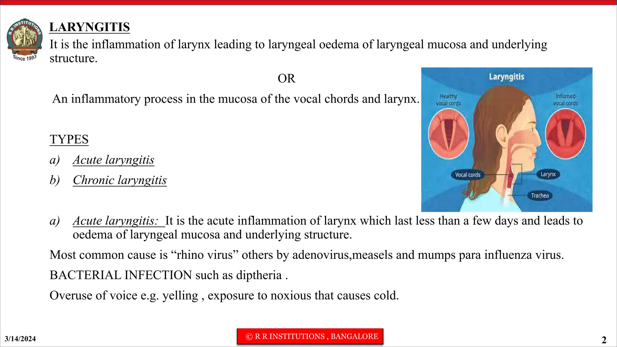 LARYNGITIS AND ITS NURSING MANAGEMENT.pdf