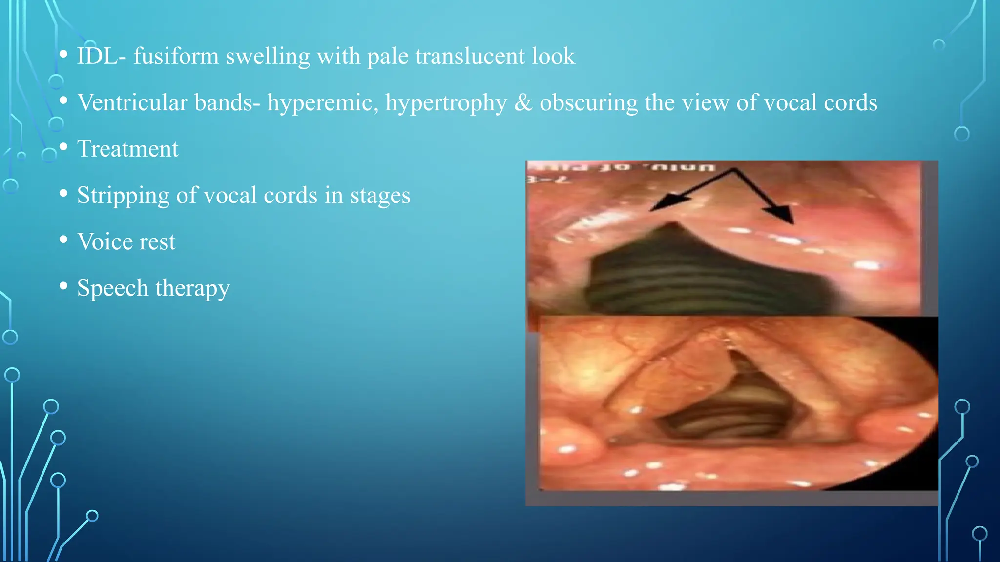 LARYNGITIS and chronic inflammation ppt | PPTX