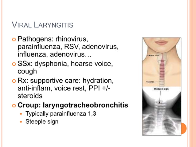 Laryngitis | PPTX
