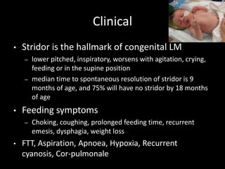 Laryngomalacia | PPTX