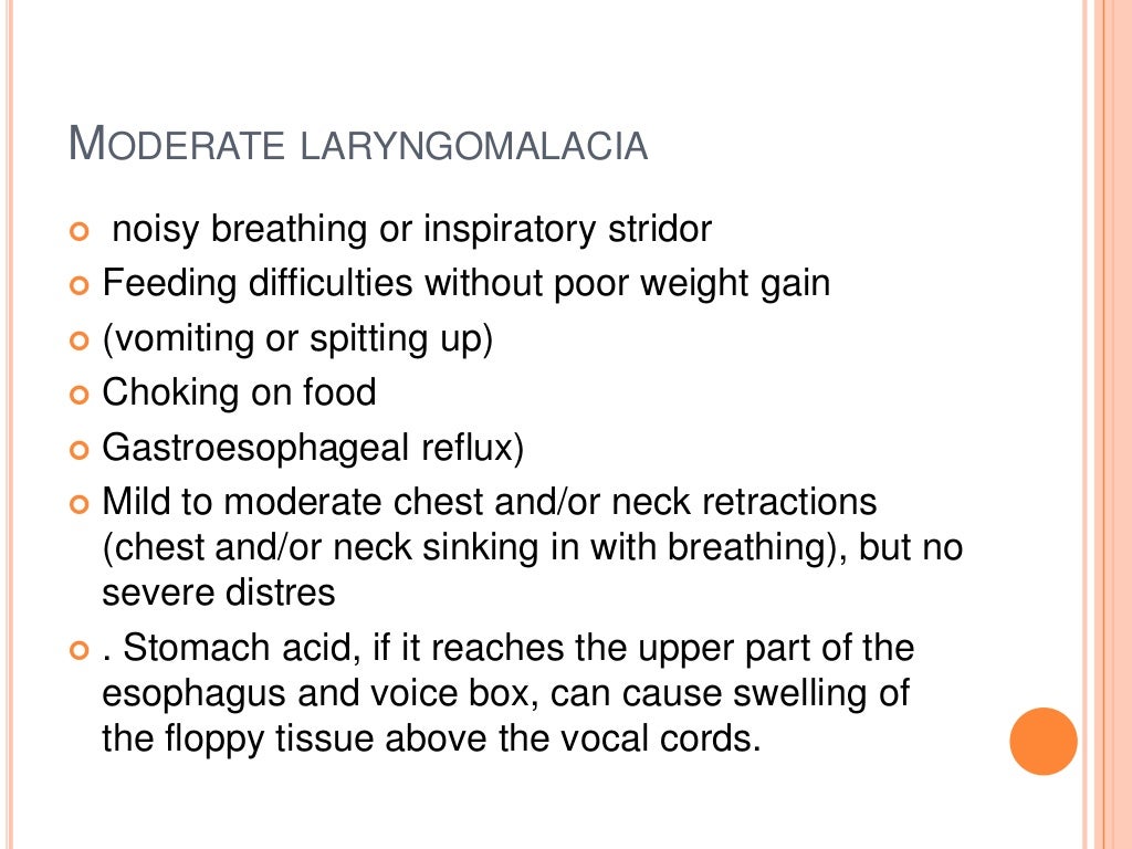 Laryngomalacia BY ZAINAB AHMED