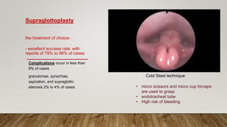 Laryngomalcia | PPTX