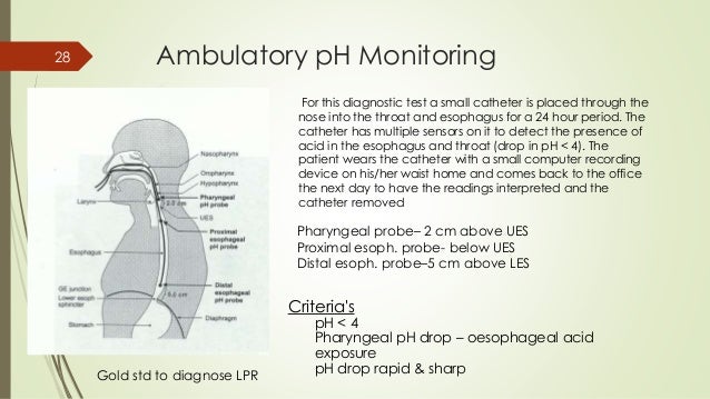 Larynx And Acid Reflux