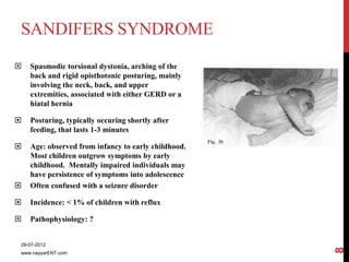 Laryngopharyngeal reflux 2 | PPT