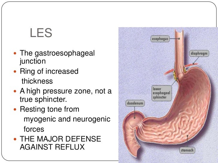Laryngopharyngeal reflux / ENTARDS