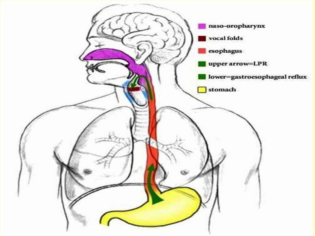 Laryngo pharyngeal reflux (lpr)