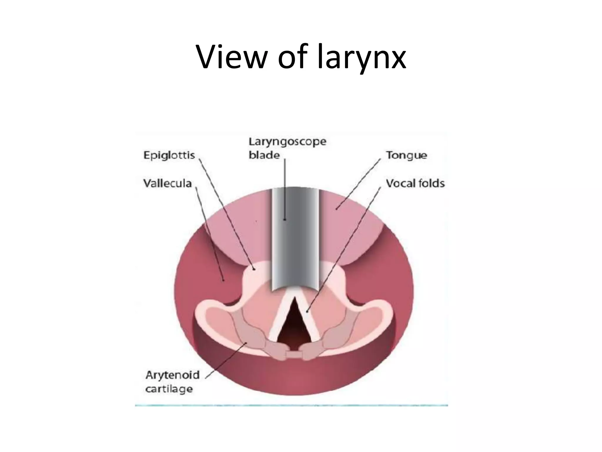 laryngoscope class by Dr Sandeep Singh Jadon ppt.pptx