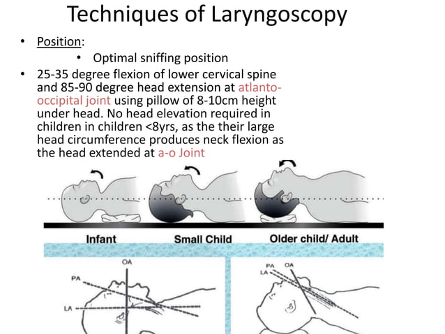 laryngoscope class by Dr Sandeep Singh Jadon ppt.pptx | Operating ...