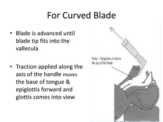 laryngoscope class by Dr Sandeep Singh Jadon ppt.pptx
