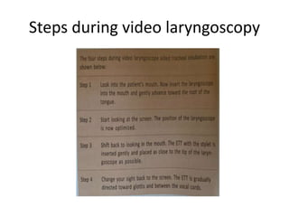 laryngoscope class by Dr Sandeep Singh Jadon ppt.pptx