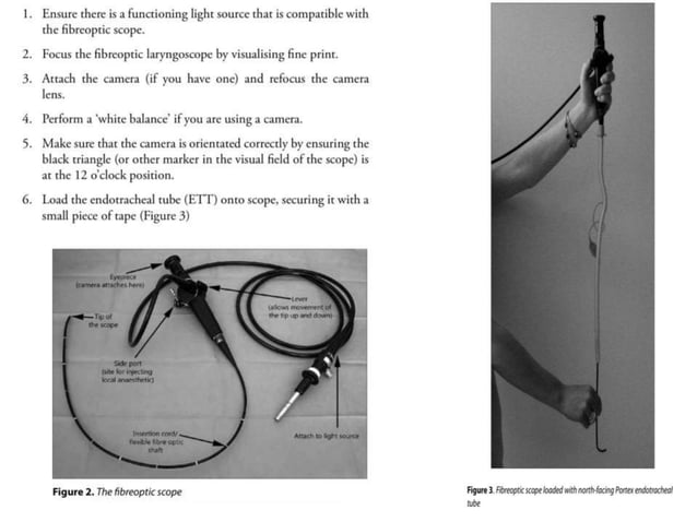 laryngoscope class by Dr Sandeep Singh Jadon ppt.pptx | Operating ...