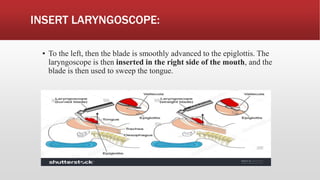 LARYNGOSCOPE pp.pptx