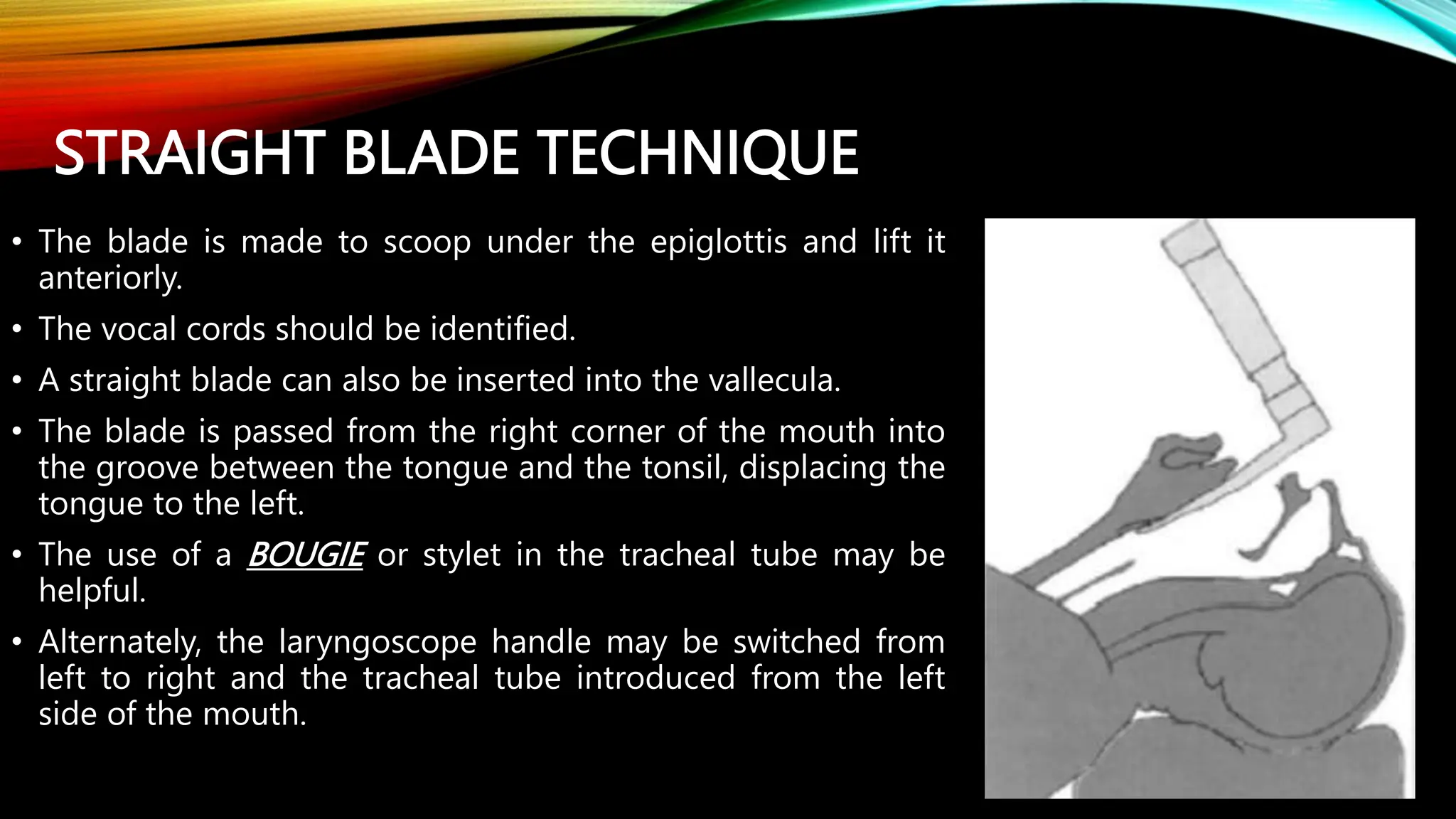 Laryngoscopes and types of laryngoscope and how to use fiberoptic ...