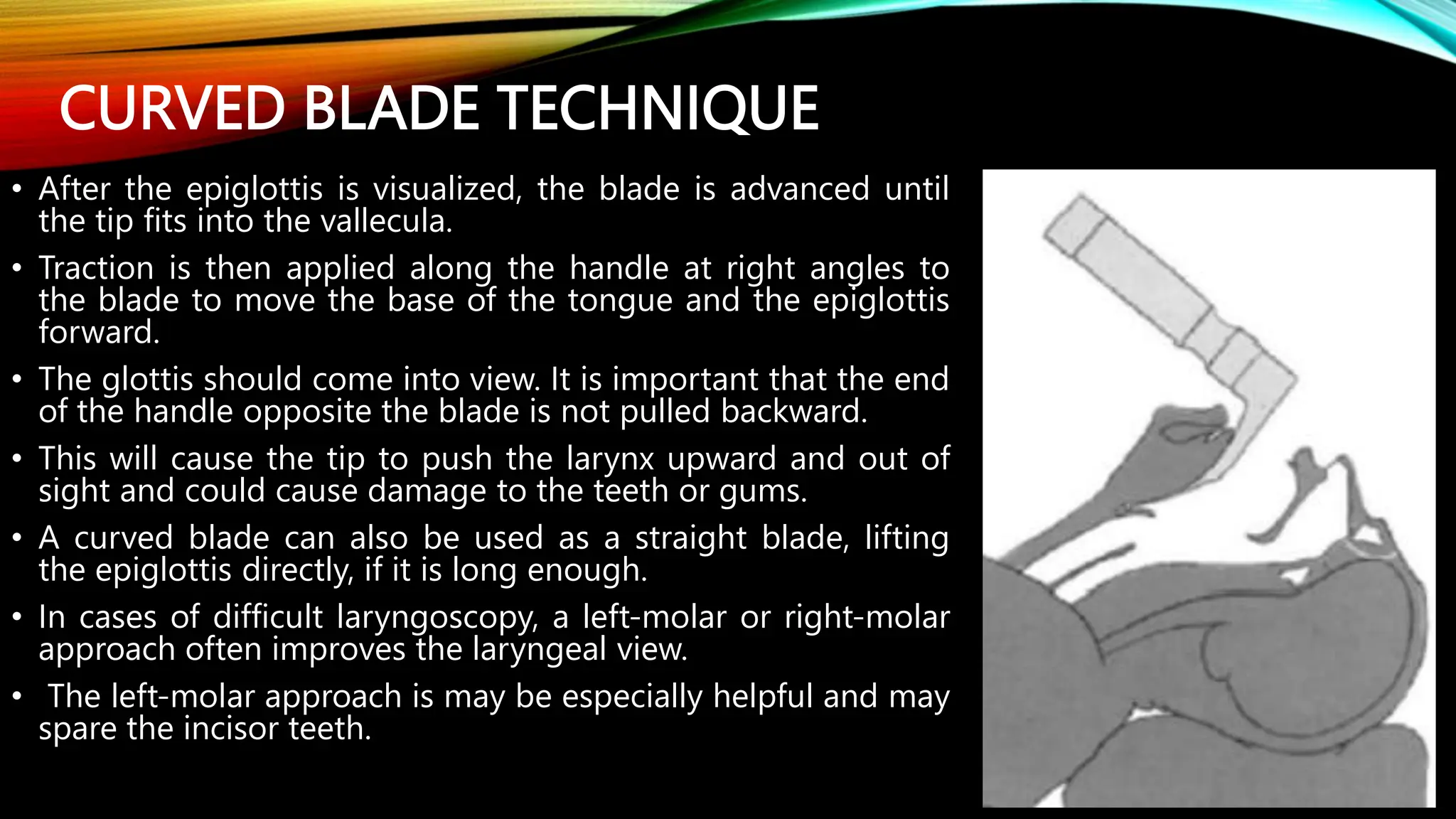 Laryngoscopes and types of laryngoscope and how to use fiberoptic ...