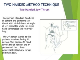 #Laryngoscopes face mask-airway & endotracheal tubes | PPTX