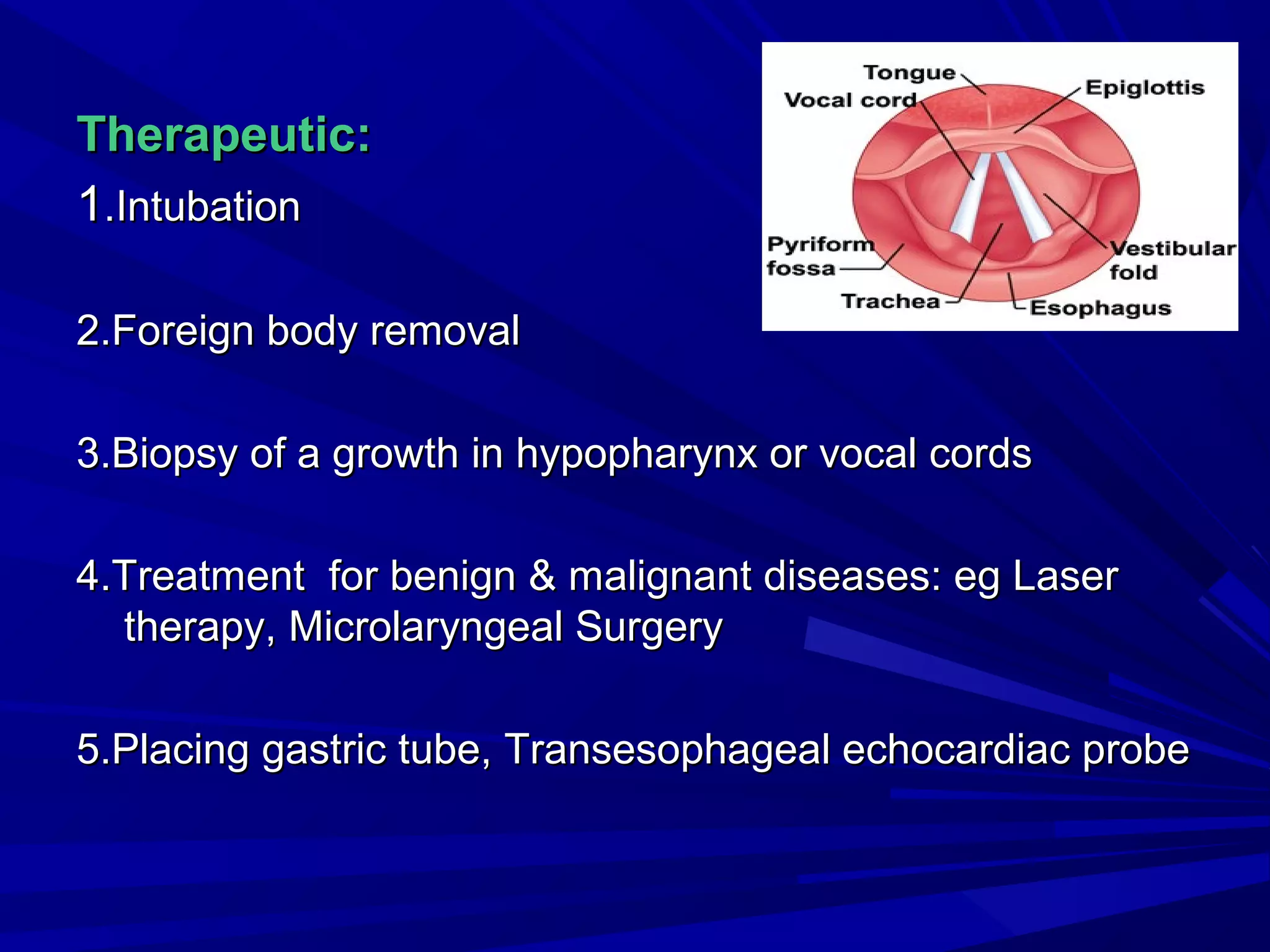 Laryngoscopy | PPT