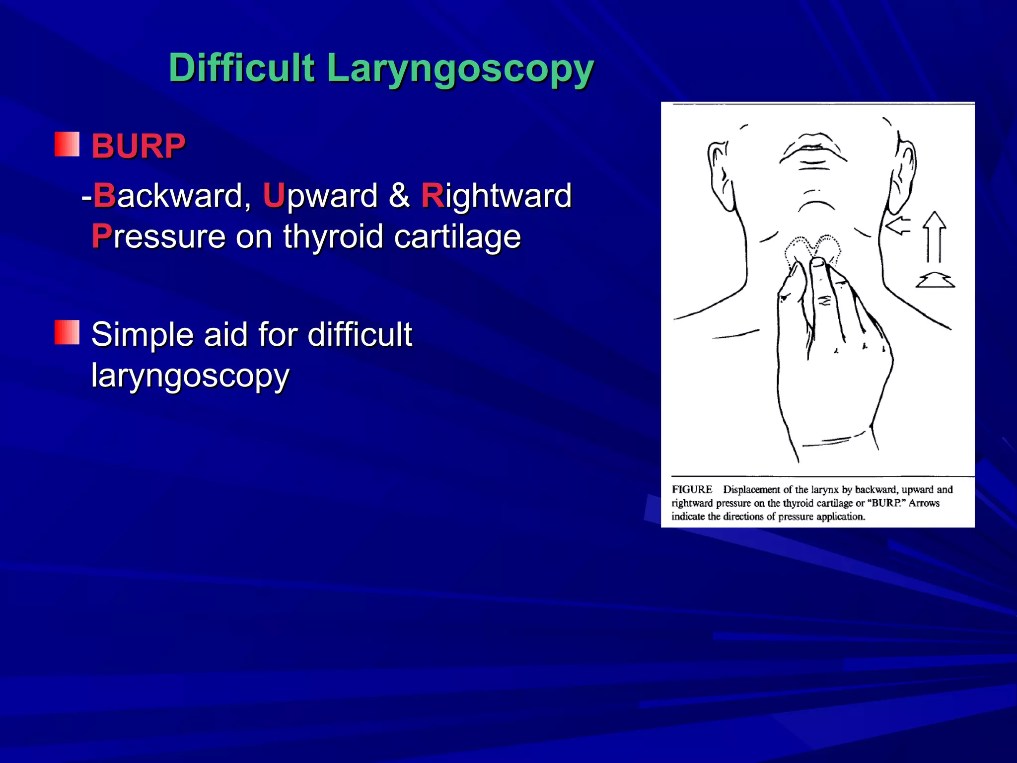 Laryngoscopy | PPT