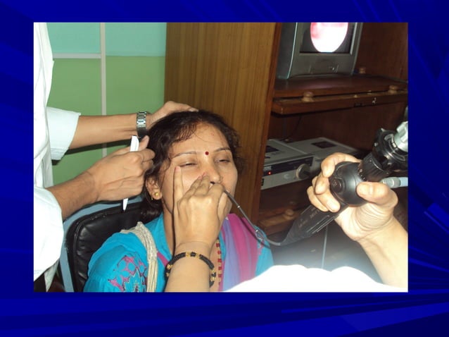 Laryngoscopy | PPT | Ear, Nose and Throat Conditions | Diseases and ...