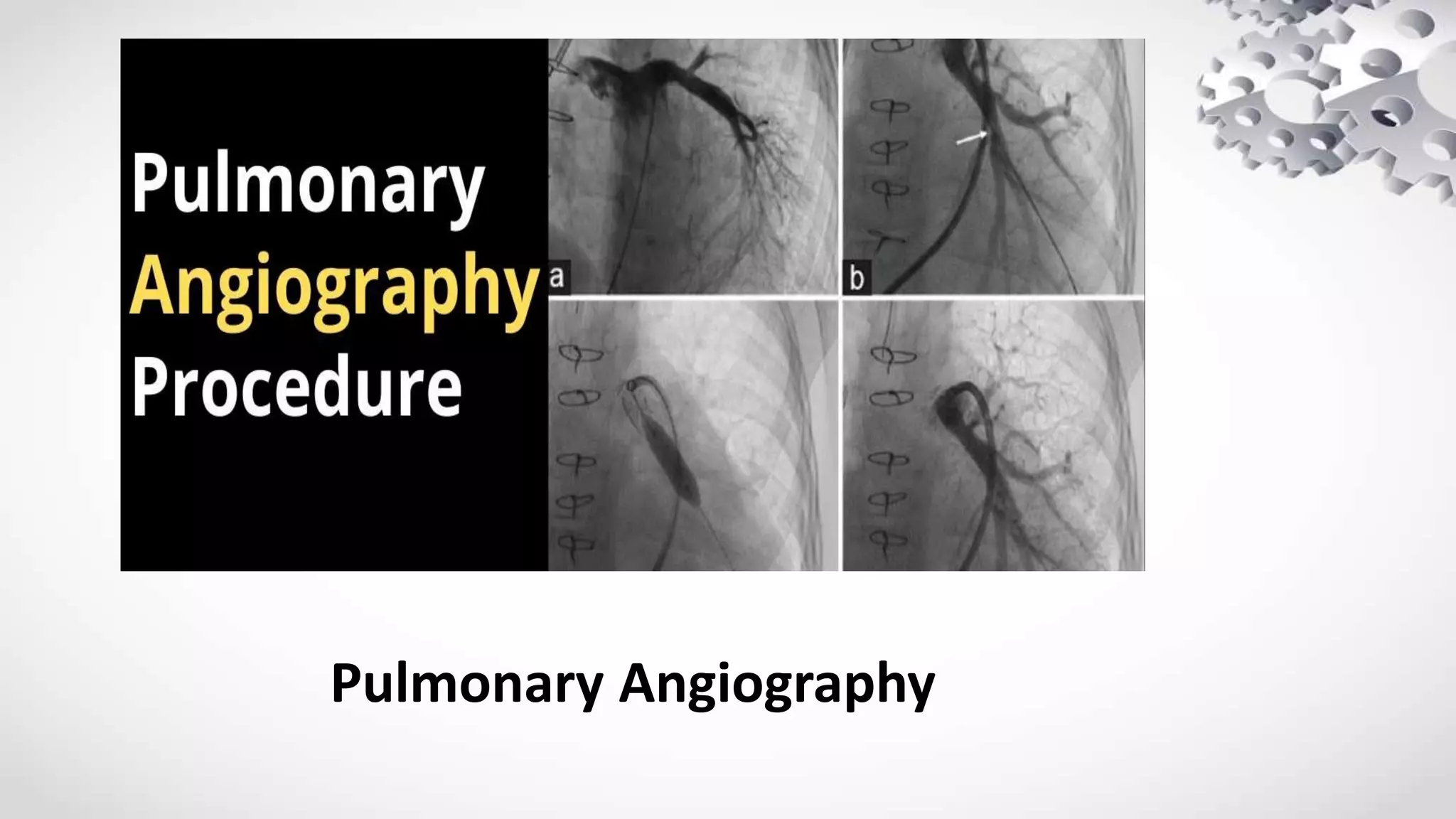 laryngoscopy thoracoscopy thoracocentesis pulmonary angiograpy.pptx