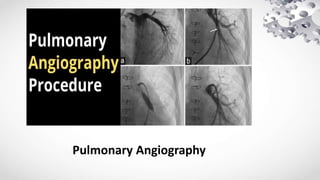 laryngoscopy thoracoscopy thoracocentesis pulmonary angiograpy.pptx