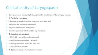 Laryngospasm management dr.siva (1).pptx