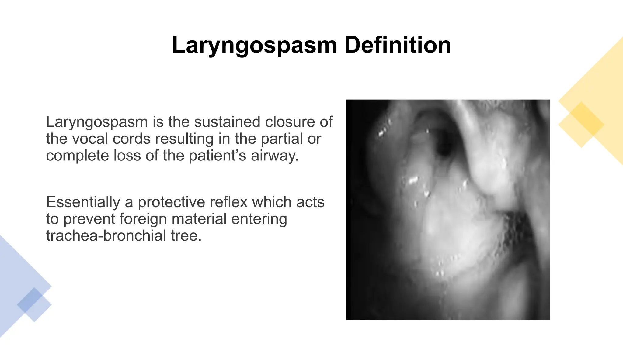 Laryngospasm Presentation.pptx By Ak (Anesthesia ) | PPTX