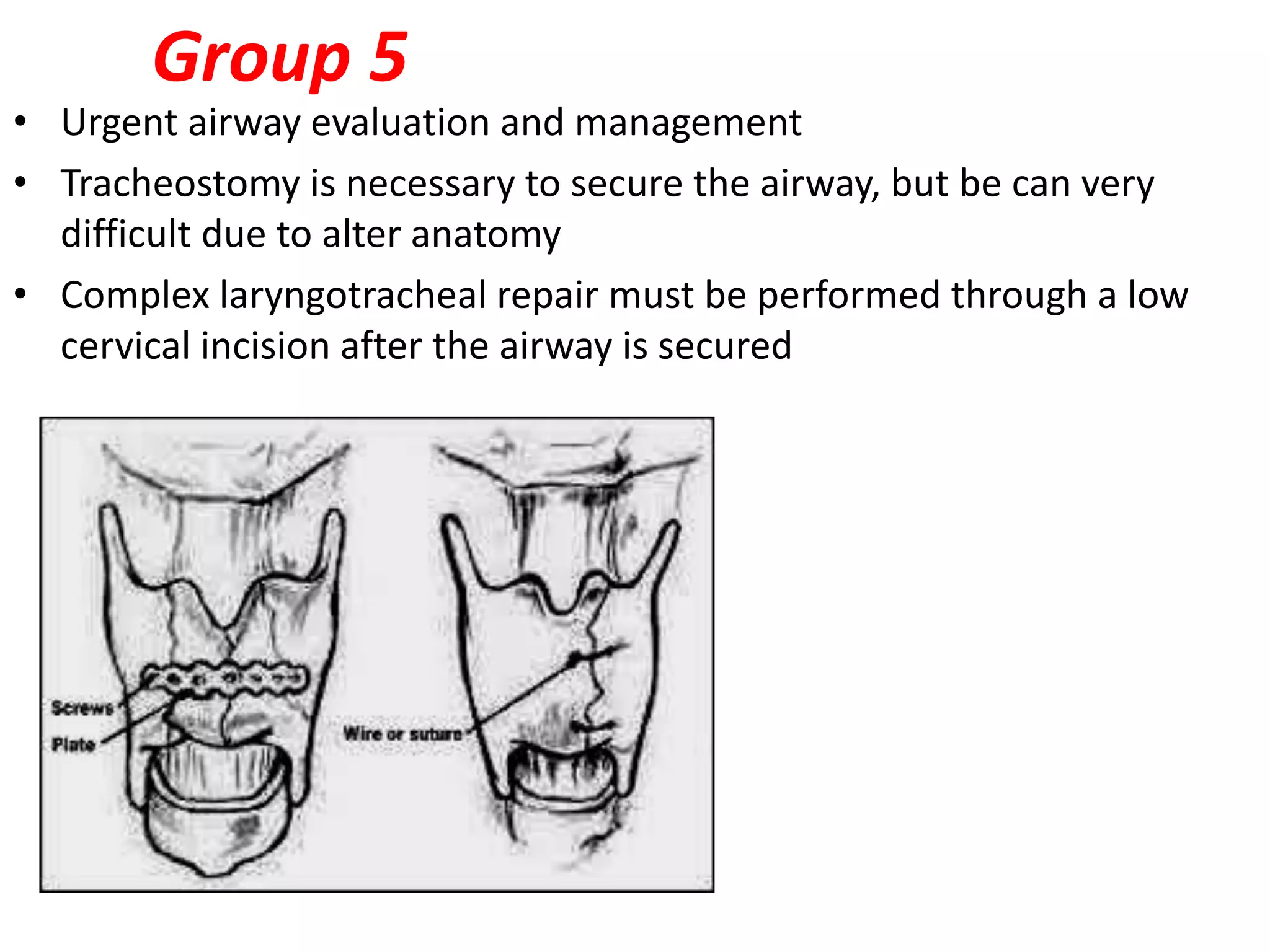 Laryngotracial trauma with anatomy and management | PPTX