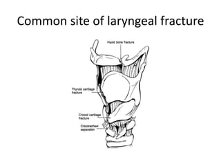 Laryngotracial trauma with anatomy and management | PPTX