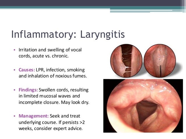 Larynx