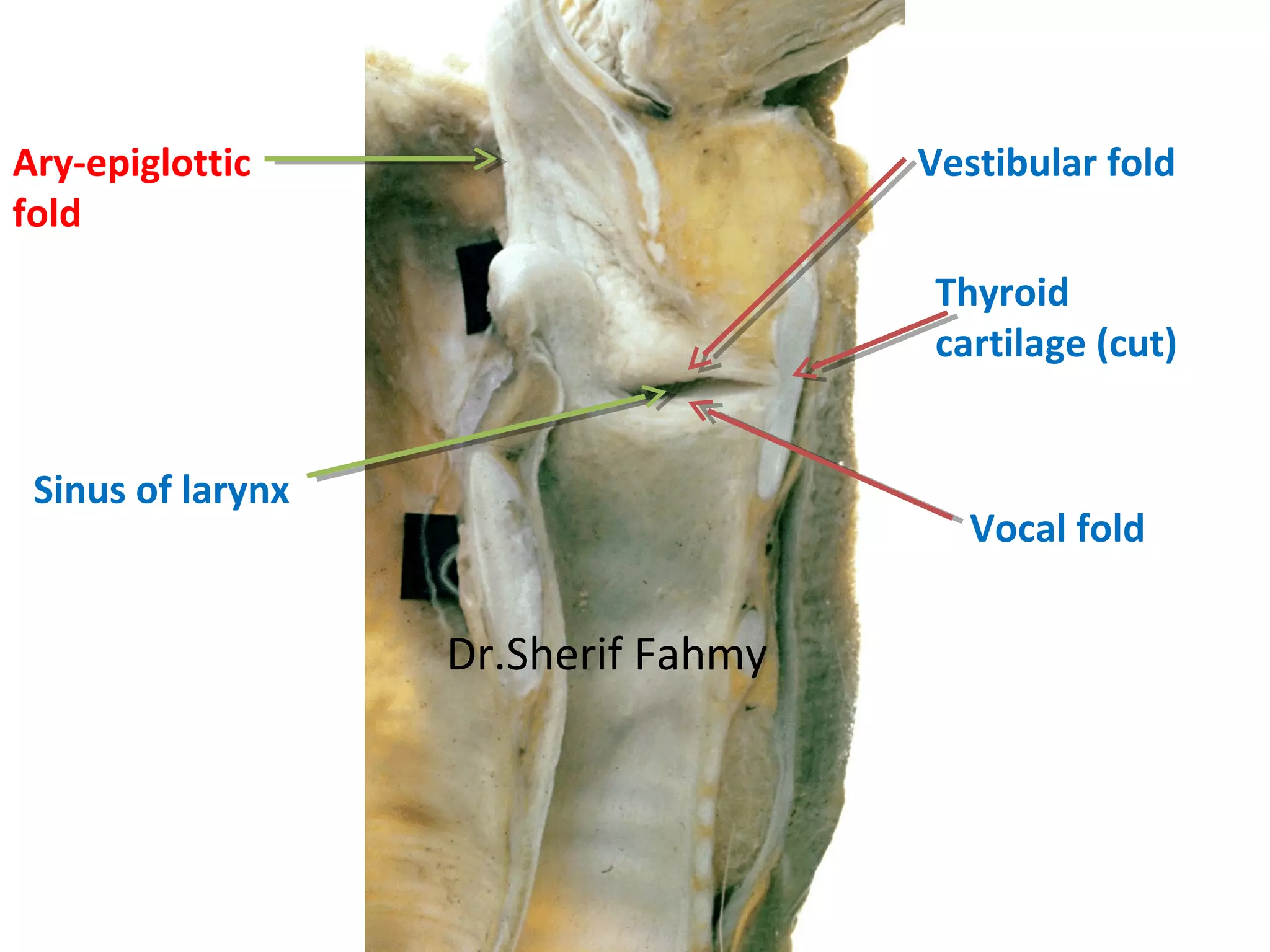 The Larynx (Anatomy of the Neck) | PPS