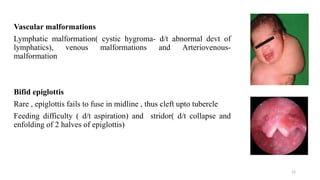 Larynx | PPTX