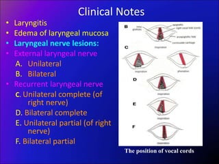 LARYNX.pptx