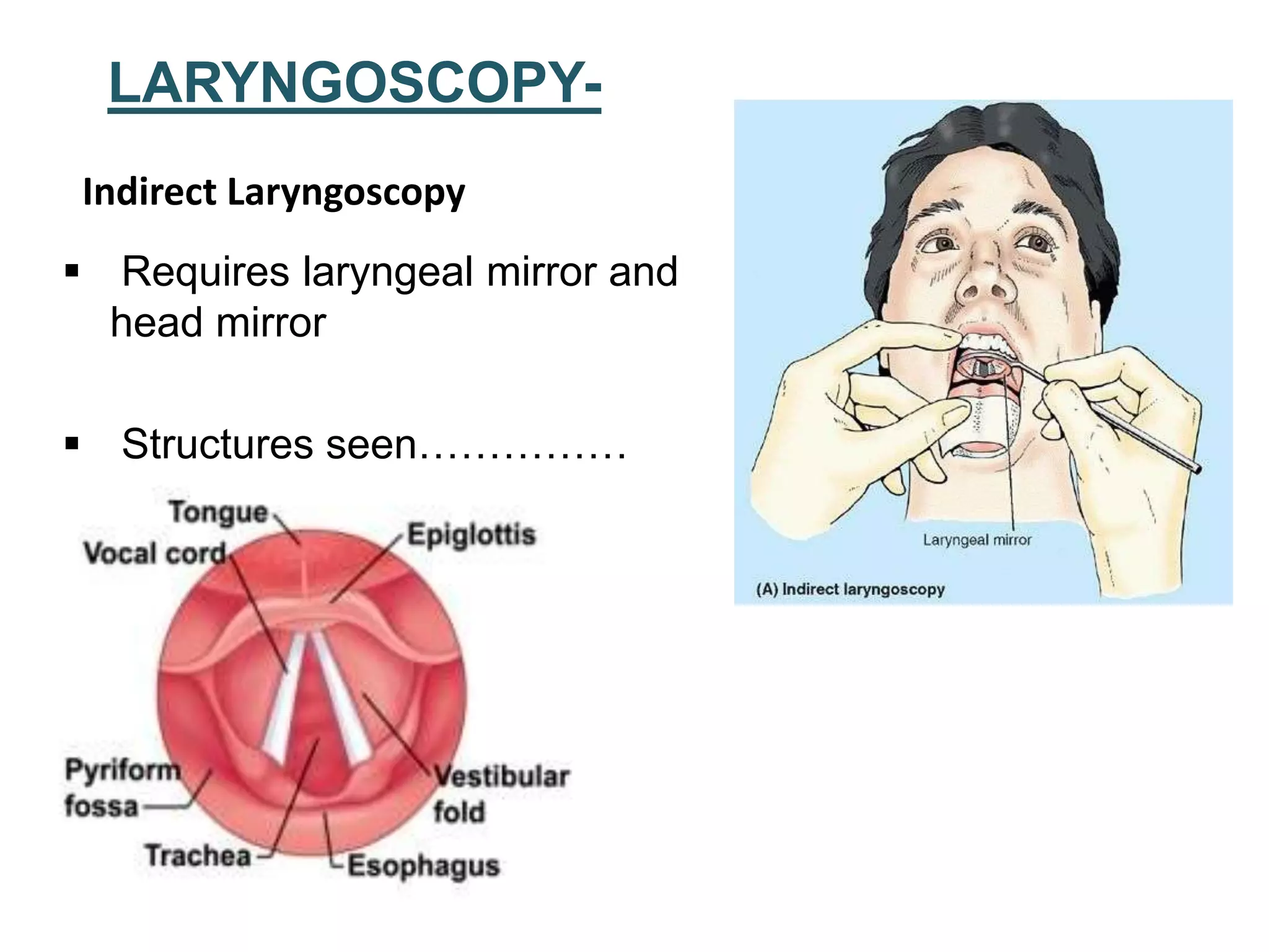 Larynx | PPTX