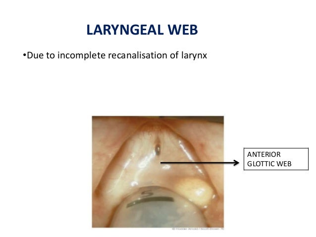 Larynx