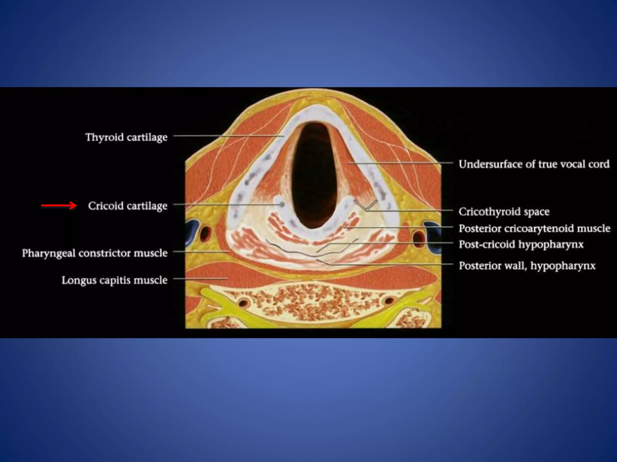 Larynx anatomy and laryngeal ca | PPTX