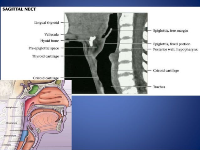 Larynx anatomy and laryngeal carcinoma