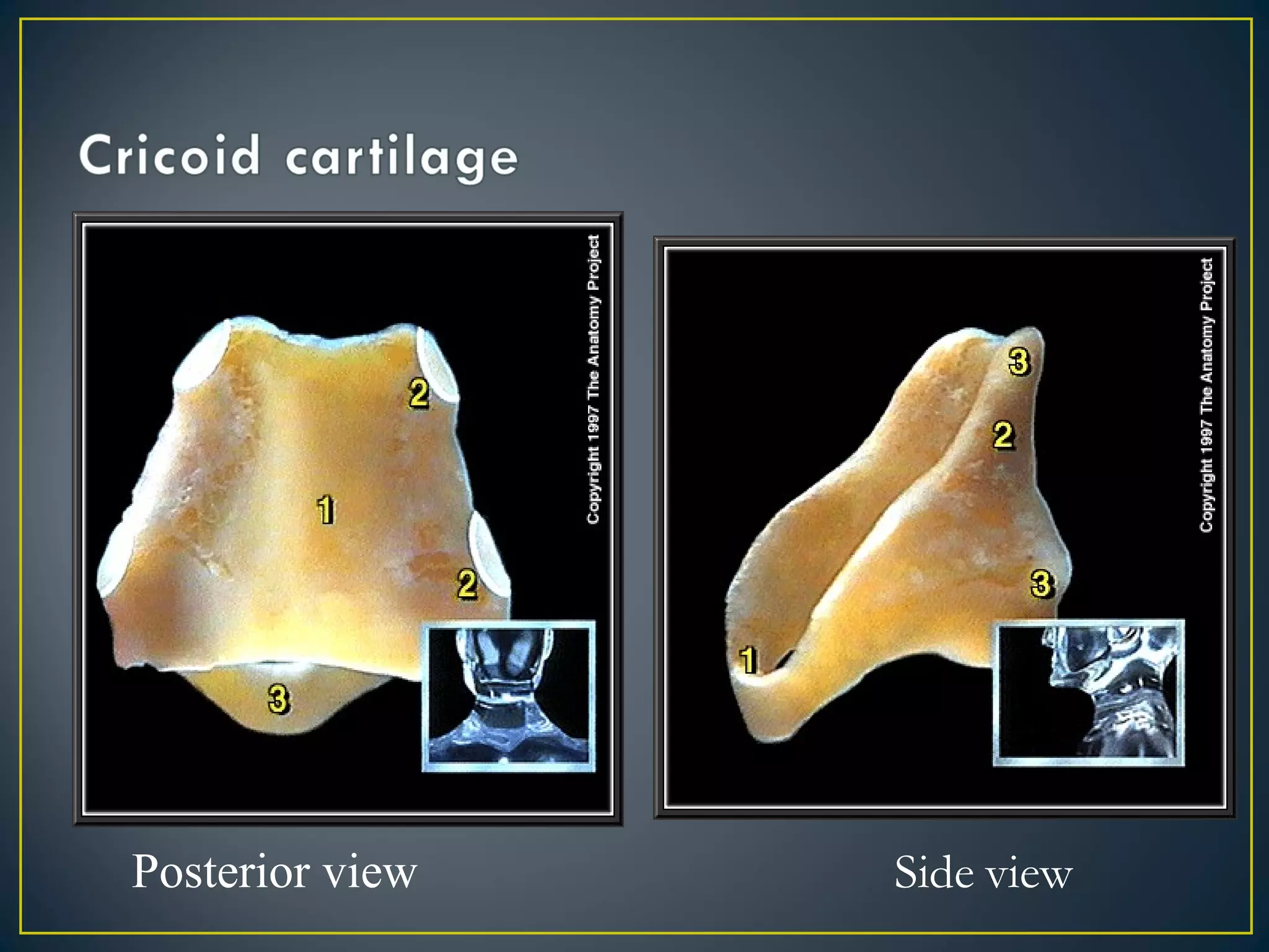 Larynx anatomy ct and mri | PPT