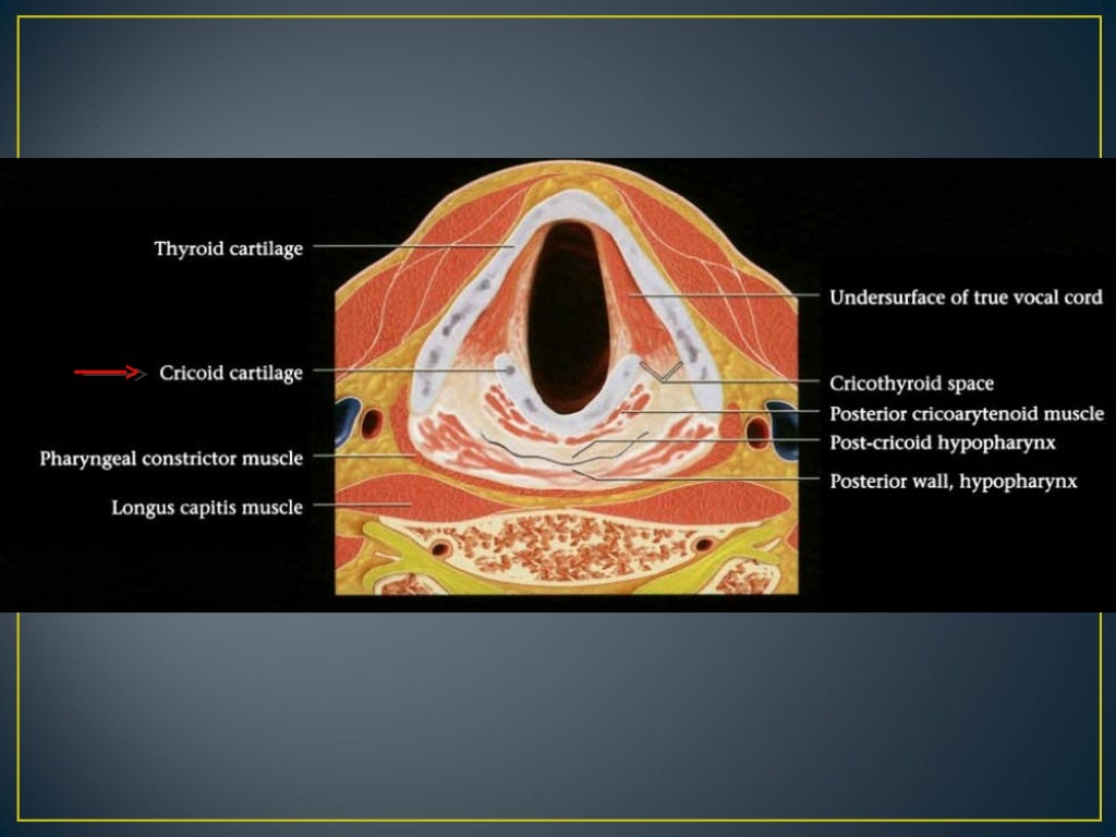 Larynx anatomy ct and mri