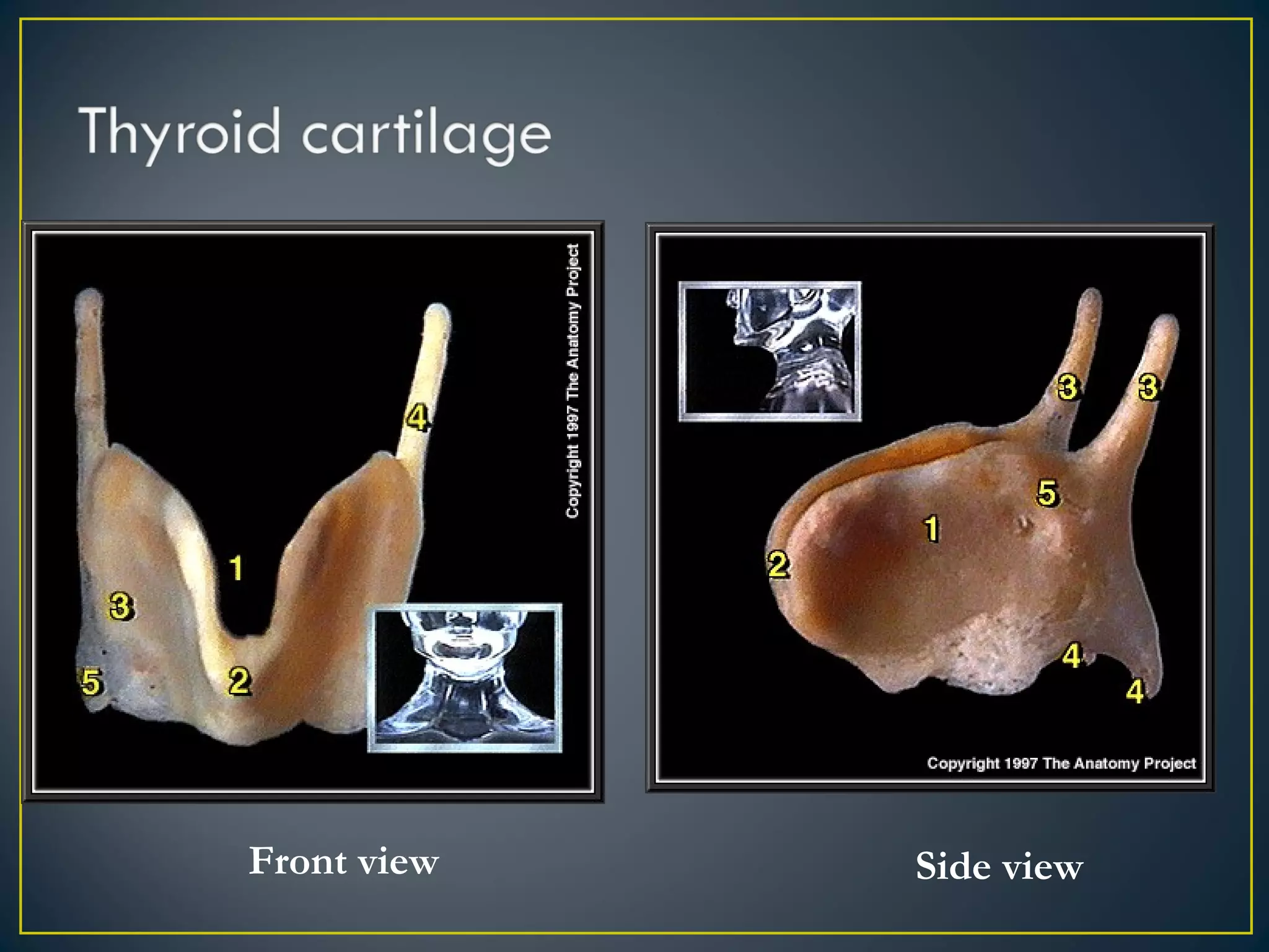 Larynx anatomy CT and MRI | PPT