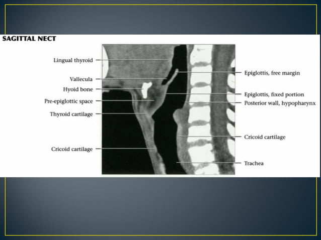 Larynx anatomy CT and MRI | PPT