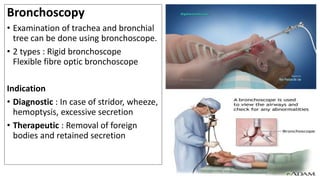 Larynx and upper airway.pptx | Thyroid Disorders | Endocrine and ...