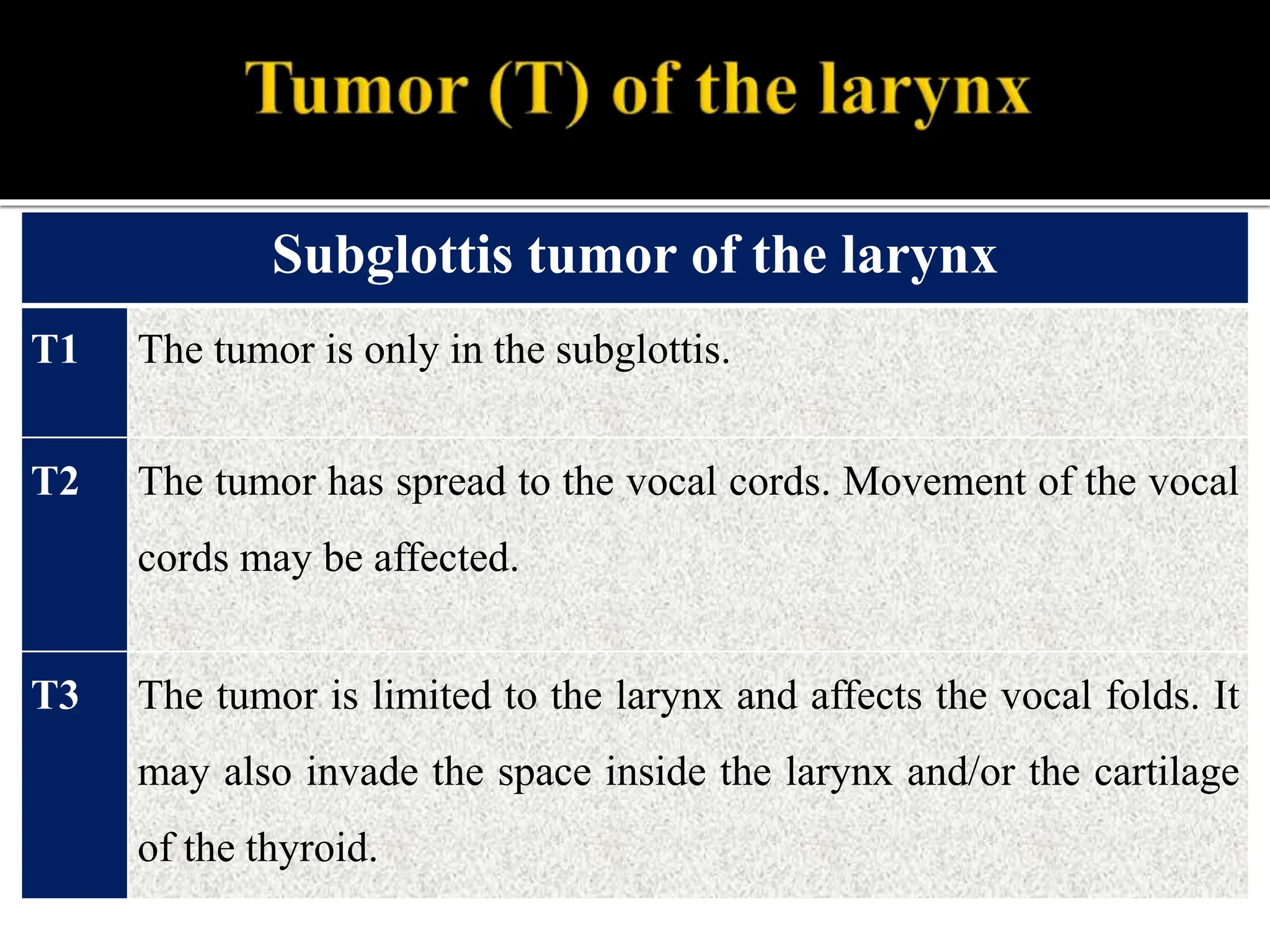 Larynx cancer.pptx