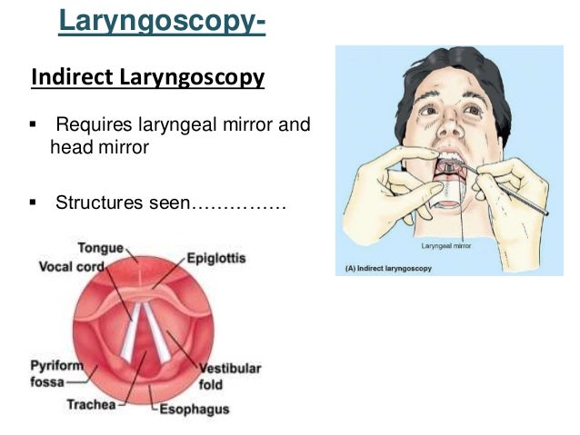 Larynx Anatomy