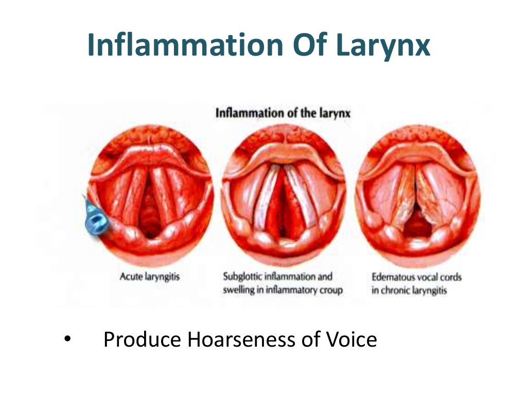 Larynx Anatomy