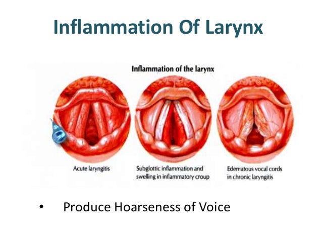 Larynx Anatomy