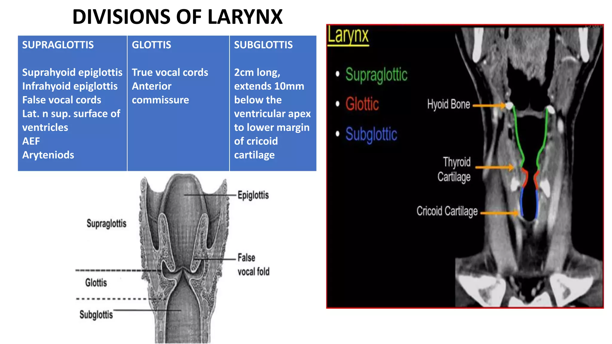 larynx anatomy, radiology and diagnostic work up.pptx | Thyroid ...