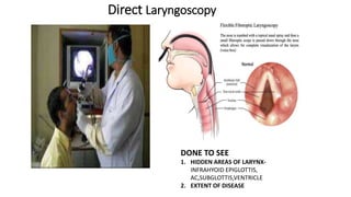 larynx anatomy, radiology and diagnostic work up.pptx