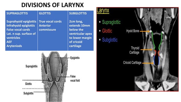 larynx anatomy, radiology and diagnostic work up.pptx